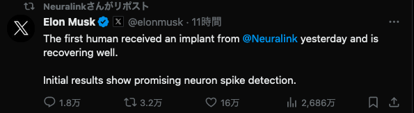 マスク氏のニューラリンク、脳内チップ初移植が完了 | AAiT | AAiT